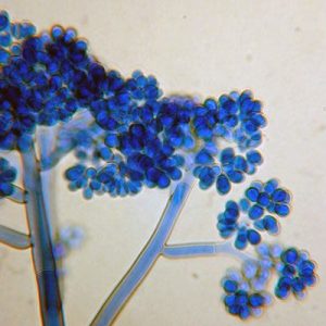 Botrytis Cinerea: How to Prevent and Control It - Epic Gardening