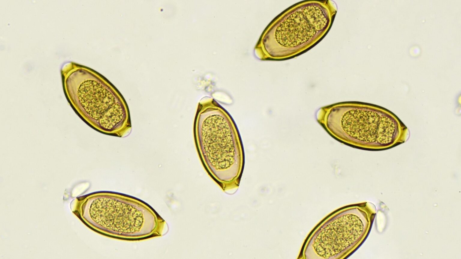 Using Beneficial Nematodes as Pest Control